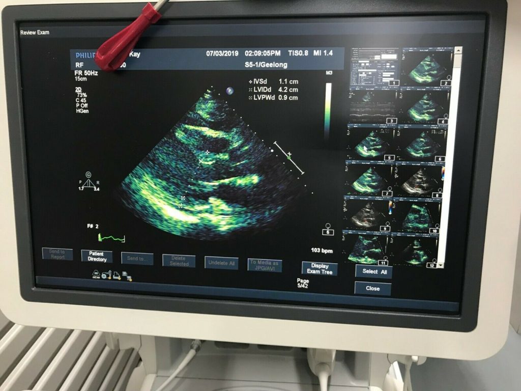 Philips iE33 Ultrasound Machine