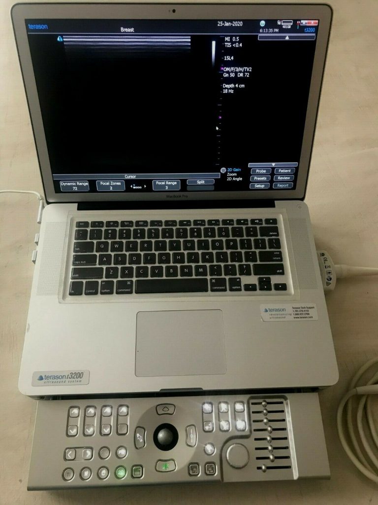 Terason t3200 Ultrasound System
