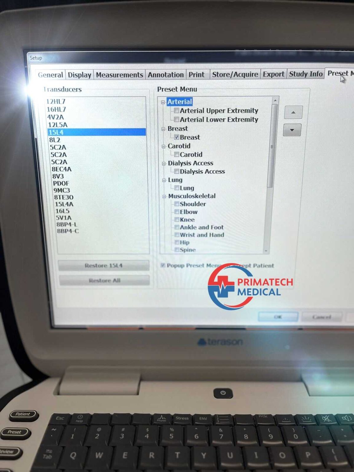 Terason uSmart 3300 NexGen Ultrasound System - Primatech Medical